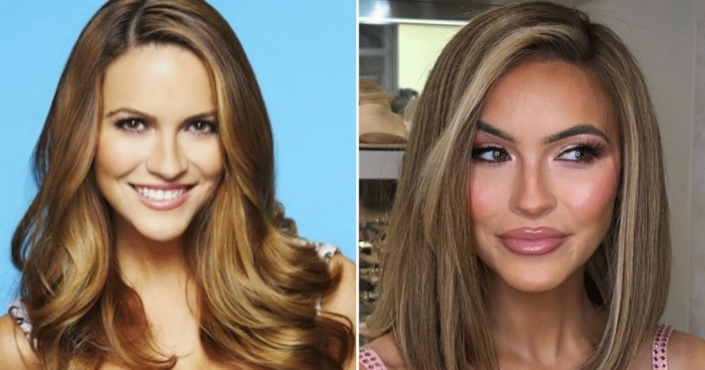 The Selling Sunset cast look so different before and after surgery