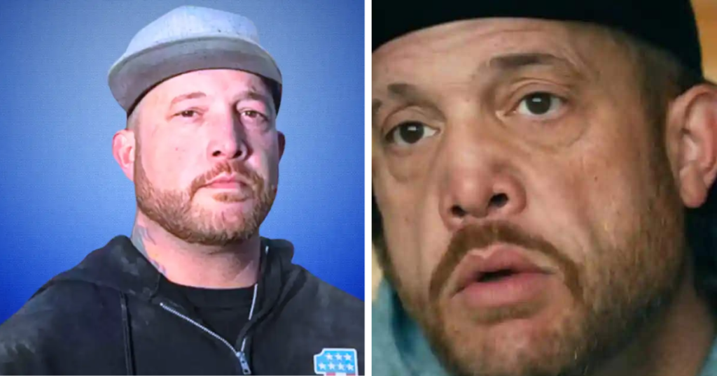 What really happened to Rick's face on Gold Rush?