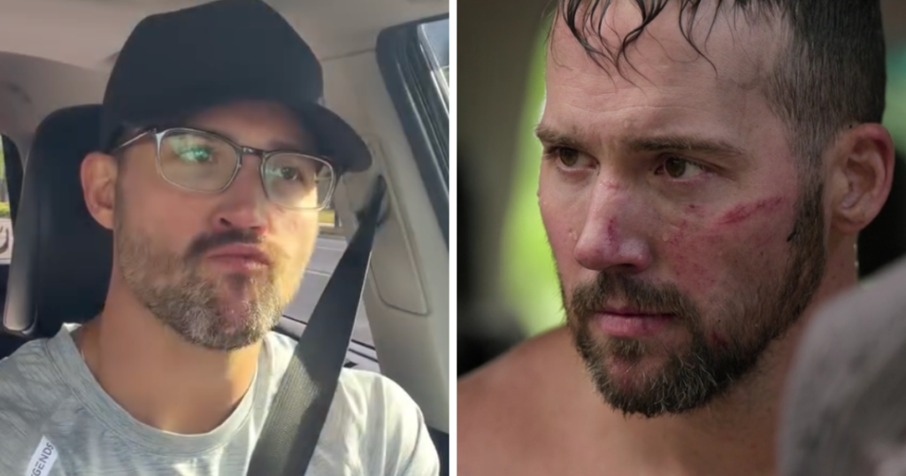 Sean breaks silence on burns while filming Outlast: The Jungle